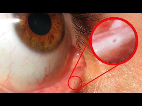 People are only just learning what the mysterious little holes in our ...