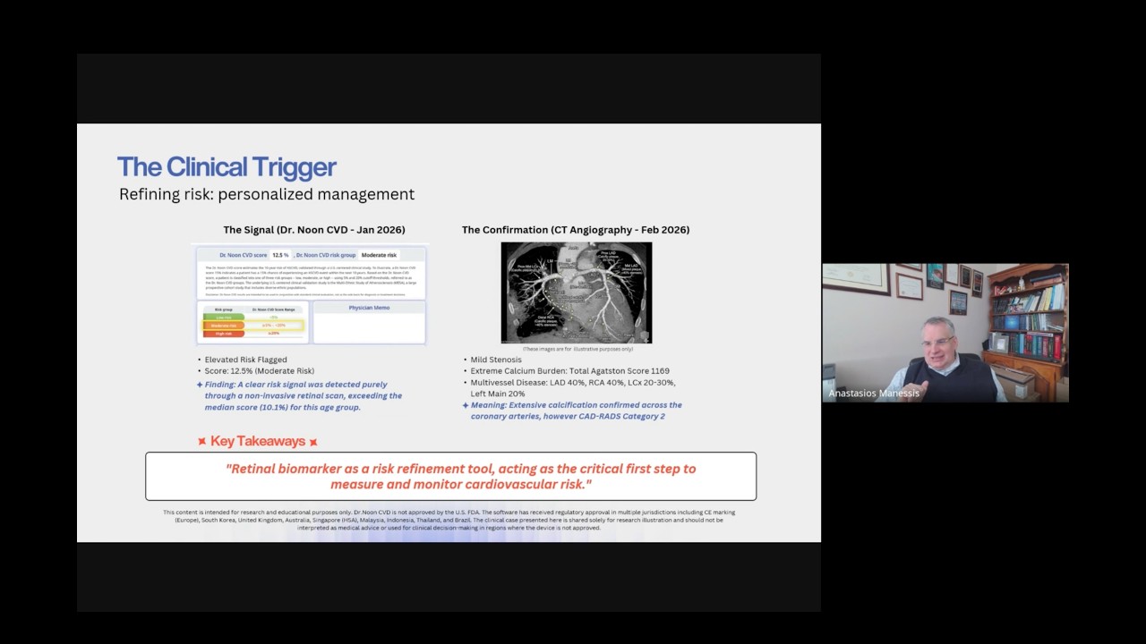 [Interview] Retinal AI for Cardiovascular Risk Prediction: A U.S. Endocrinologist's Perspective