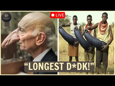 LIVE:Top 25 People with Shockingly Oversized Body Parts You Won’t Believe Exist