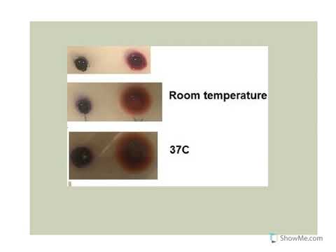 Passive Transport - Simple & Facilitated Diffusion