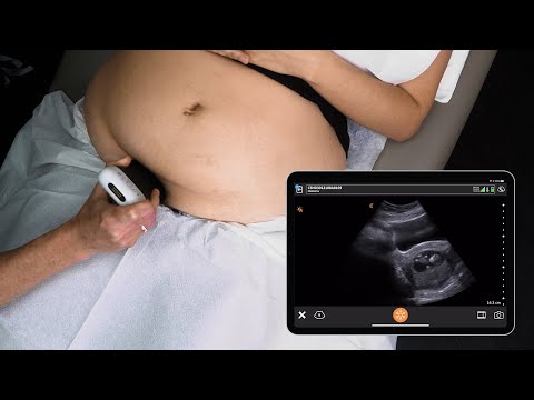 First Trimester: Gestational Age