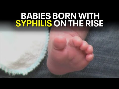 Texas doctors concerned about rising number of babies born with syphilis