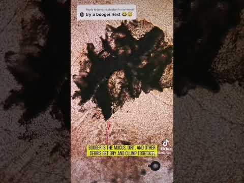 Booger under the microscope #laboratory #booger #saudiarabia #saudi #mucus #microscope