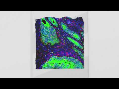 A 360 Degree View of Tumor Biology