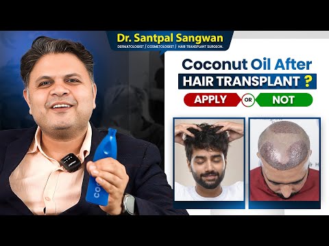 Should You Use Coconut Oil After Hair Transplant? | Expert Advice from Dr. Santpal Sangwan