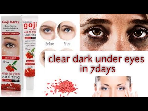 CLEAR DARK EYES CIRCLE IN 7DAY//HONEST REVIEW ON GOJI BERRY.
