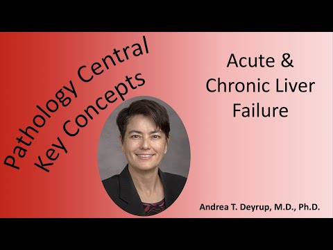 Medical School Pathology: Pathophysiology of Acute & Chronic Liver Failure