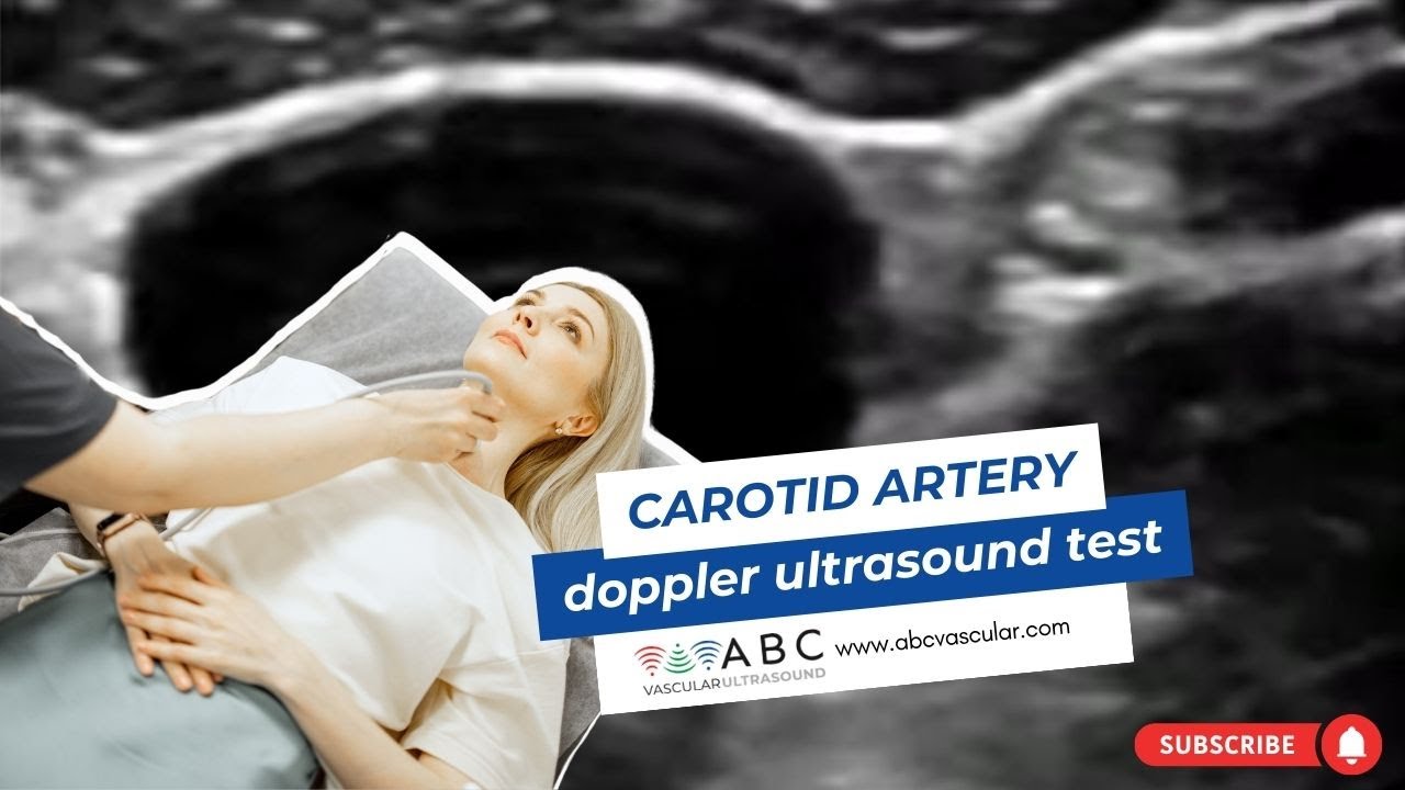 Carotid artery Doppler ultrasound test. Accurate examination to perform a basic ultrasound carotid.