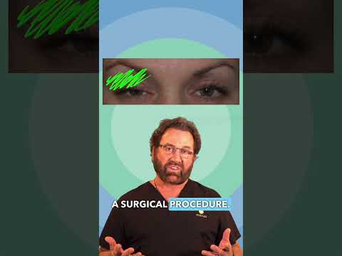 How to Treat Ptosis: Causes, Symptoms, and Solutions