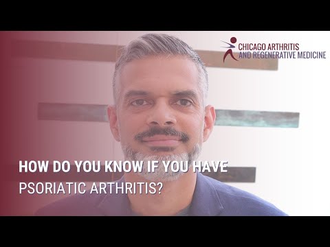 How Do You Know If You Have Psoriatic Arthritis?