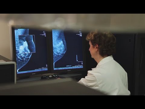 Link between breast cancer and melanoma
