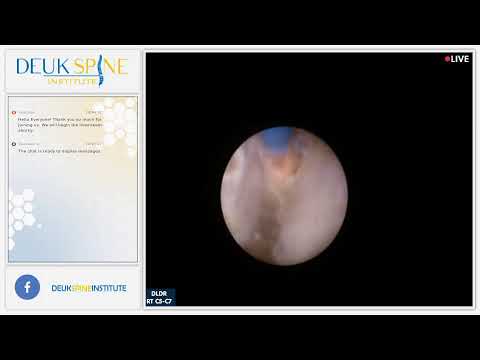 Watch Live Back Treatment! DLDR C5-C7