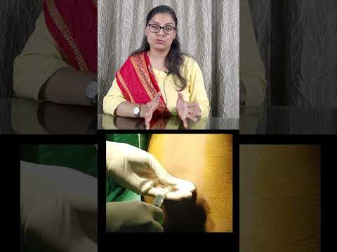 Cesarean Delivery mein Kaun Si Behoshi di Jati hai | Anesthesia in Cesarean Section | #shortsindia