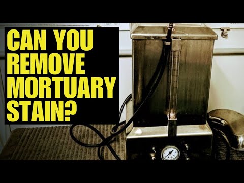 Can Livor Mortis be removed?