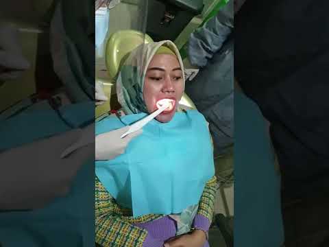 Gimana Rasanya SCALING GIGI? 😳