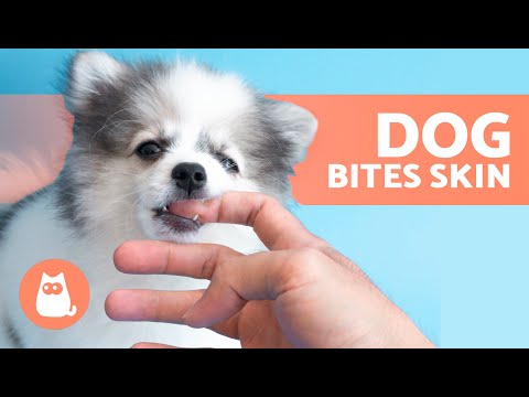 Why Has MY DOG BITTEN ME? πΆβ οΈ (8 Reasons)