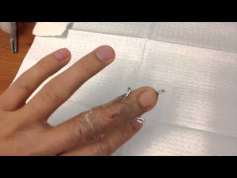 Shooting with an injured finger -The Firearm Blog