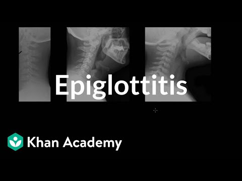 Gene Therapy Is Promising For The Treatment Of HIV. Part 3 of 3 – Sheri ...