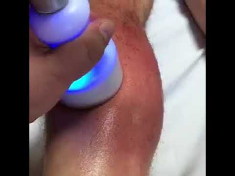 CRYO T SHOCK