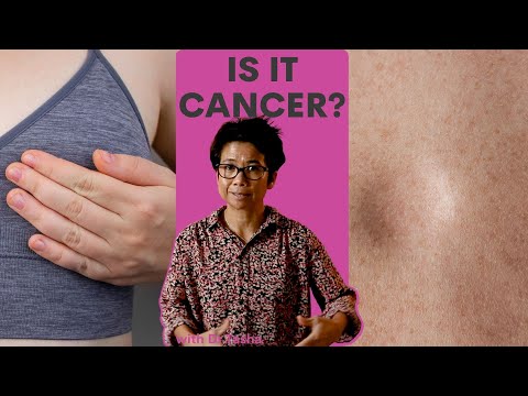 Are All Breast Lumps Cancer? With Dr Tasha