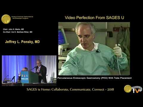 Percutaneous endoscopic gastrostomy (PEG) with tube placement