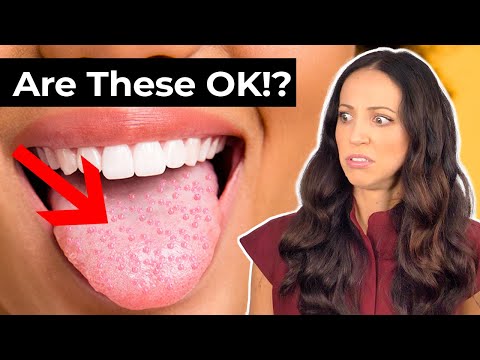 what do BUMPS on your TONGUE mean?