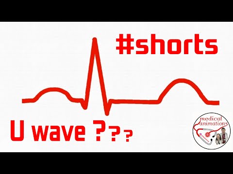U WAVE IN ECG | #shorts #pediatrics #ecg #cardiology