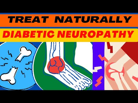 DIABETIC NEUROPATHY | How Capsaicin Use for Diabetic Neuropathy #diabetes #neuropathy #painrelief