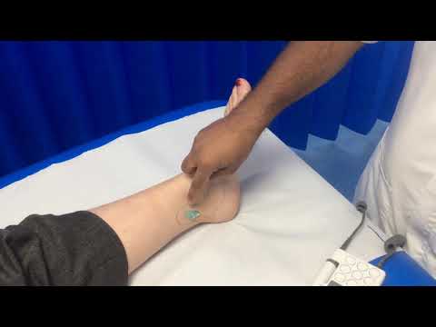 How to check for the posterior tibial pulse using a Doppler