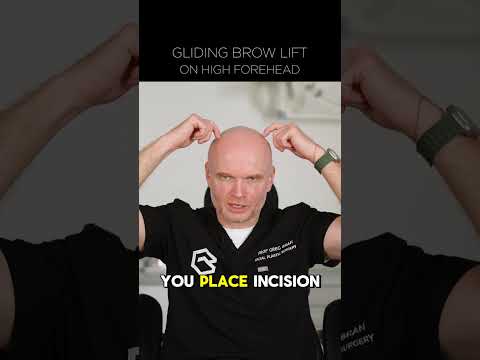 Gliding Brow Lift on High Forehead | Greg Bran