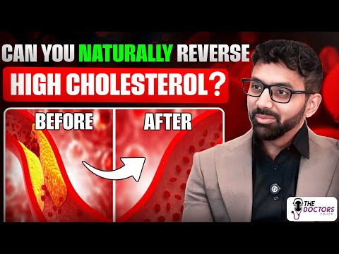 Can You Naturally Reverse High Cholesterol? Here’s What the Science Says | Dr. Rahman Mohammed