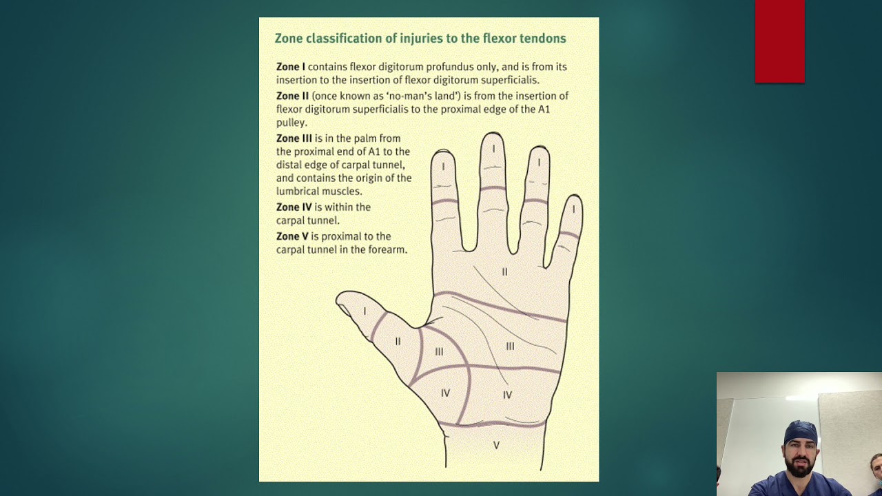 Flexor Tendon Injuries by Dr Joe Clair