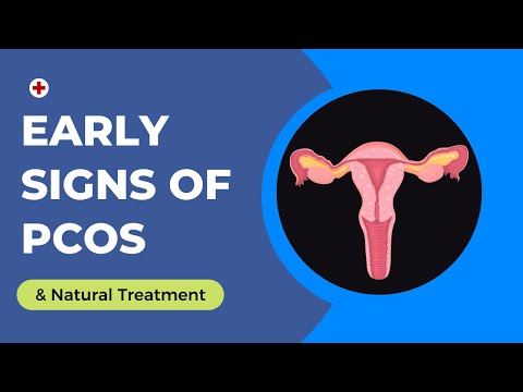 Early Symptoms of PCOS To Look For !!