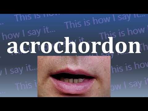 This is How I Say...acrochordon