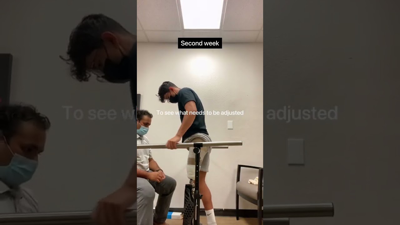 How my prosthetic sockets are made!