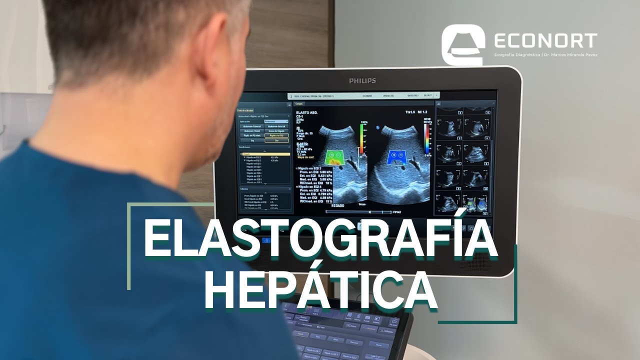 Elastografía Hepática Antofagasta - ECONORT
