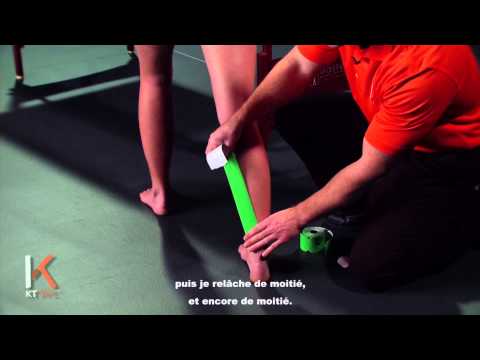 Comment soigner elongation mollet ? La réponse est sur Admicile.fr