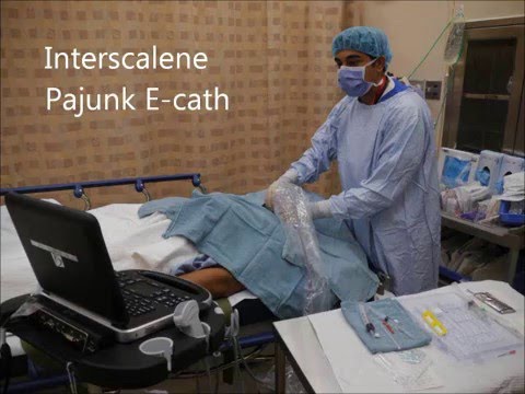 USG Interscalene Catheter Insertion (Pajunk E-cath) - Out-Of-Plane Technique