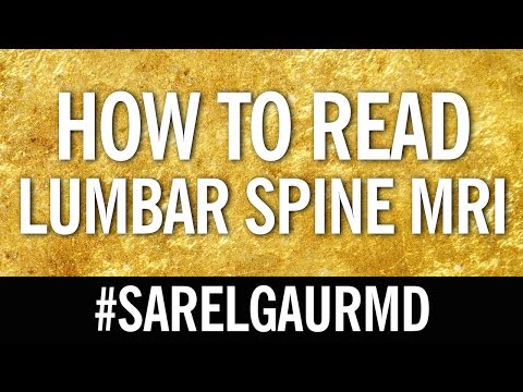 How To Read Lumbar Spine MRI: Axial Anatomy