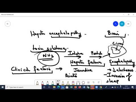 Fulminant hepatic failure