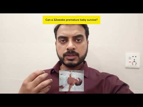 Can a 32 weeks premature baby survive after birth | complications in preterm babies