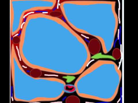 Chest x-ray, lung parenchyma and interstitium