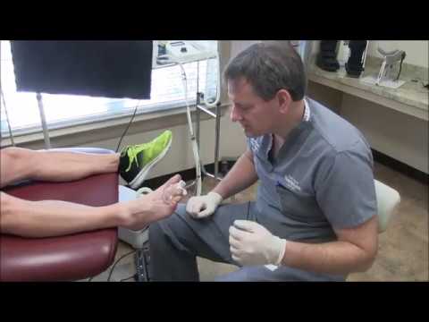 Buddy Splint for Painful Toes