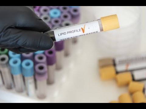 Miracle of Living: Lipids