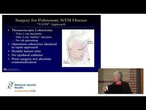 When Antibiotics are not Enough: A Surgical Approach