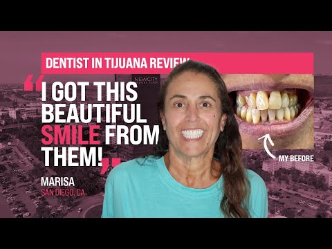 My New Smile 🦷Top Dentist in Tijuana Mexico👩‍⚕️ [2024 Xdentistry Tijuana Review]