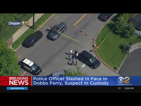Police Officer Slashed In Head In Westchester County