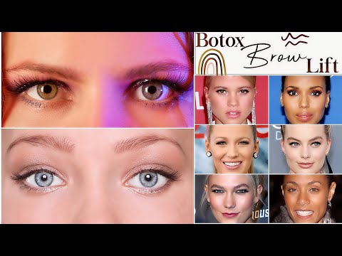 Botox Brow Lift | How Botox can help with Hooded Eyes and other Eye Shapes
