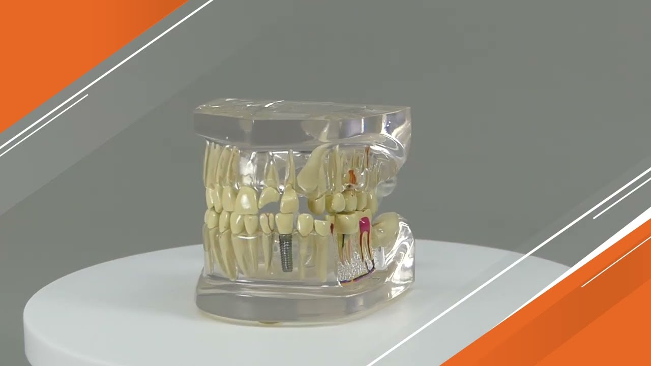 Transparent Jaw with Teeth Model | AnatomyStuff