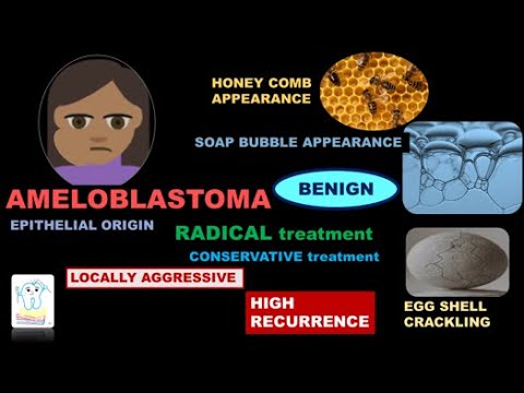 Benign Odontogenic tumour-AMELOBLASTOMA
